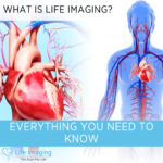 What is Life Imaging? Everything You Need to Know - Life Imaging FLA